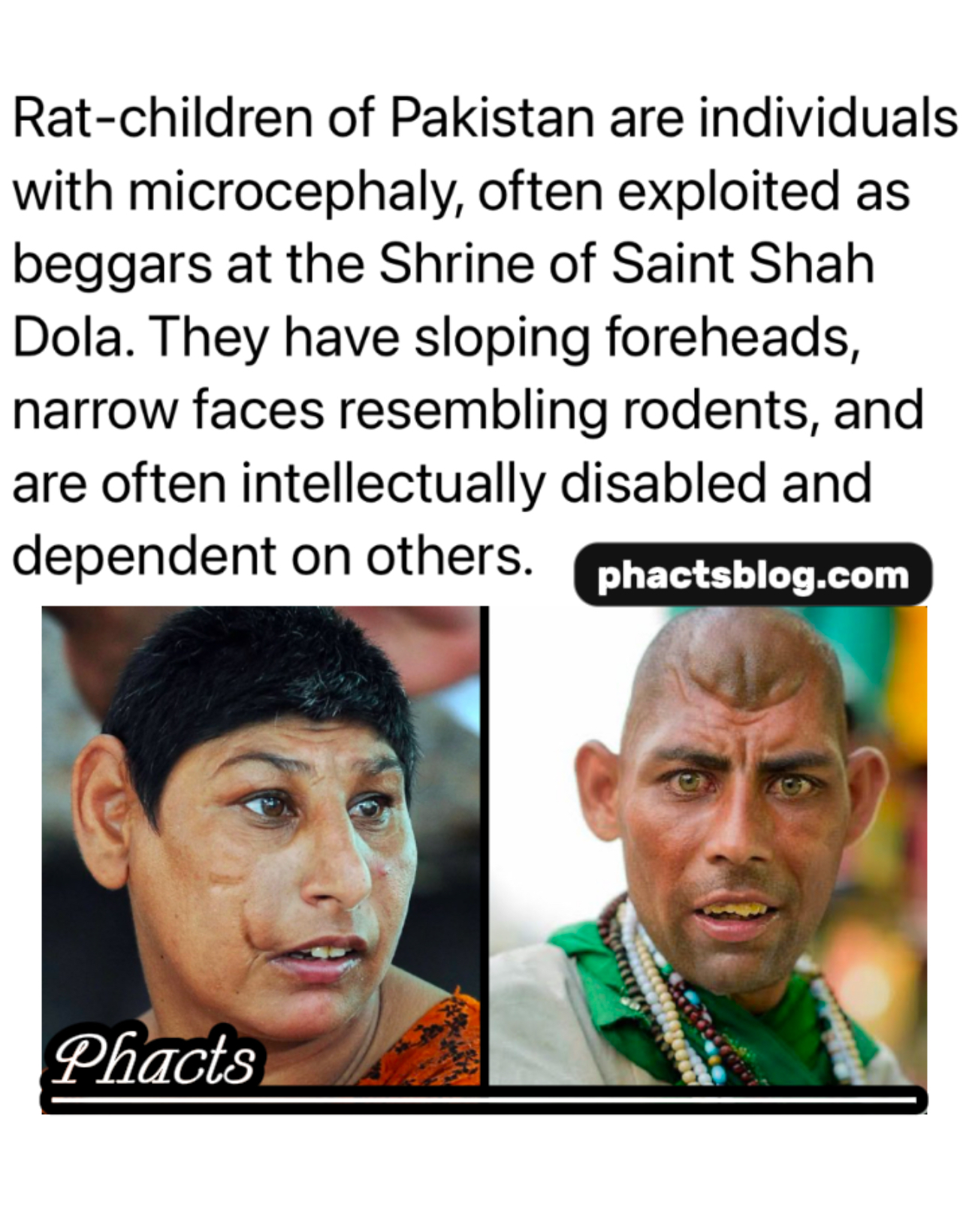 History of Pakistan’s “Rat Children” and the Shrine of Shah Dola - PHACTS